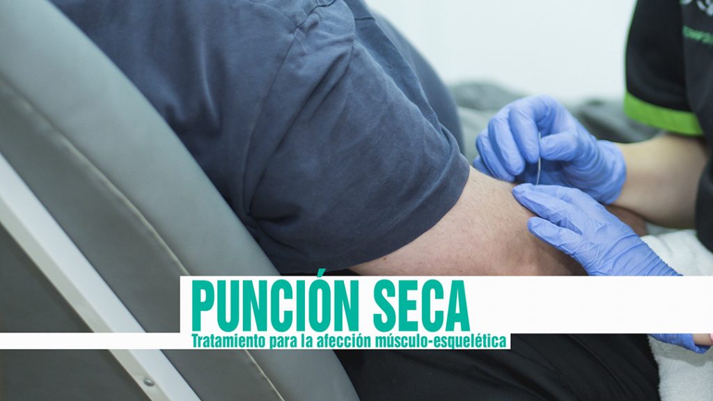 Punción Seca Getafe -Getaris, especialistas en fisioterapia avanzada